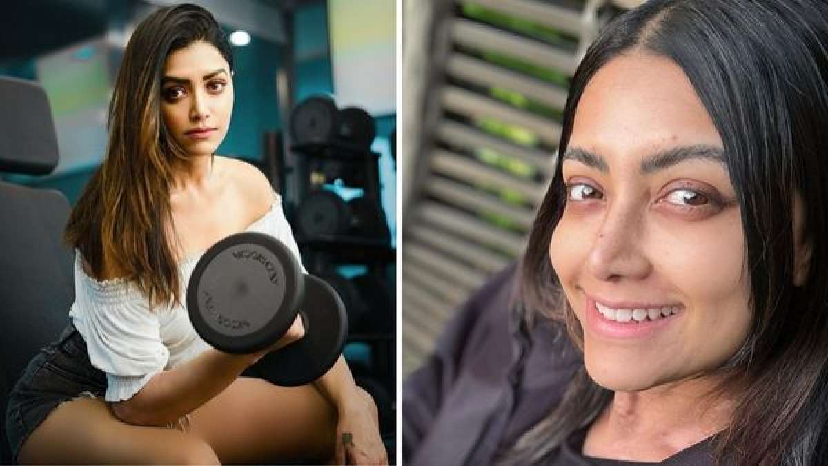 Mamta Mohandas, Who Fought Cancer Is Diagnosed With THIS Rare Disease ...
