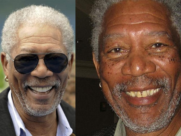 5 Hollywood Celebrities Who Have Gone Through Cosmetic Dentistry ...