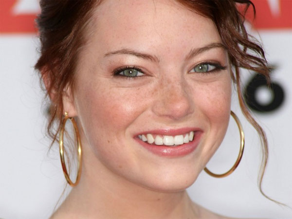 Fabulous Celebrities Who Embraced The Freckles On Their Face! - Filmibeat