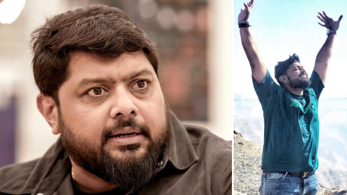 Mithun Ramesh Who Diagnosed With Bell's Palsy Shared New Update About ...