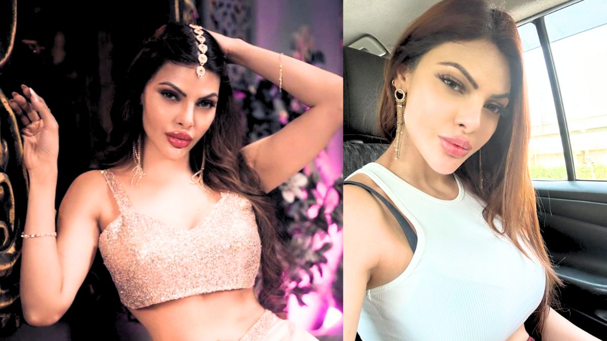 Sherlyn Chopra Reveals She Suffered Kidney Failure; Opens Up About Her Sour Relationship With ...