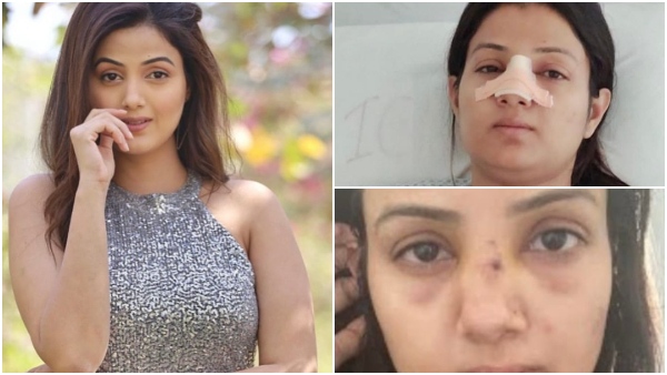 Yeh Hai Chahatein Fame Sumati Singh On Undergoing Nose Surgery After ...
