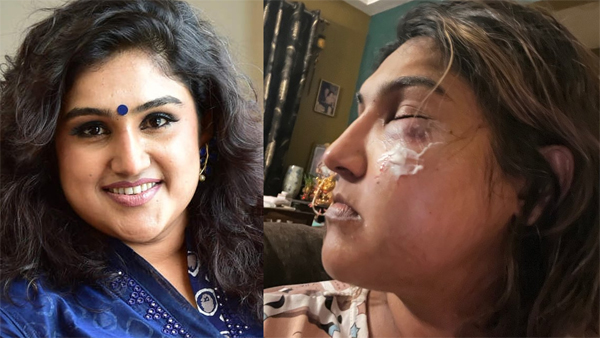 Bigg Boss Tamil 7: Vanitha Alleges Assault By Pradeep Antony Supporter ...